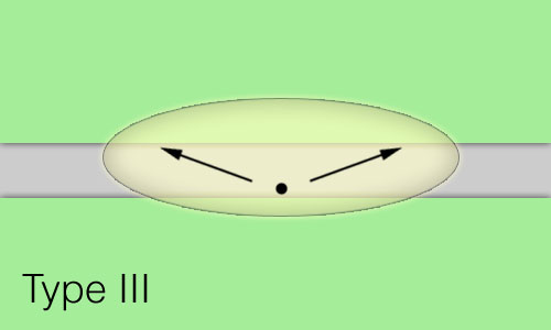 Area Light Distribution Pattern Types – Throw Light